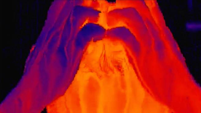 Exit Through the Cuckoo’s Nest